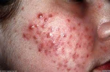 Integumentary and Sensory Pharmacology on emaze