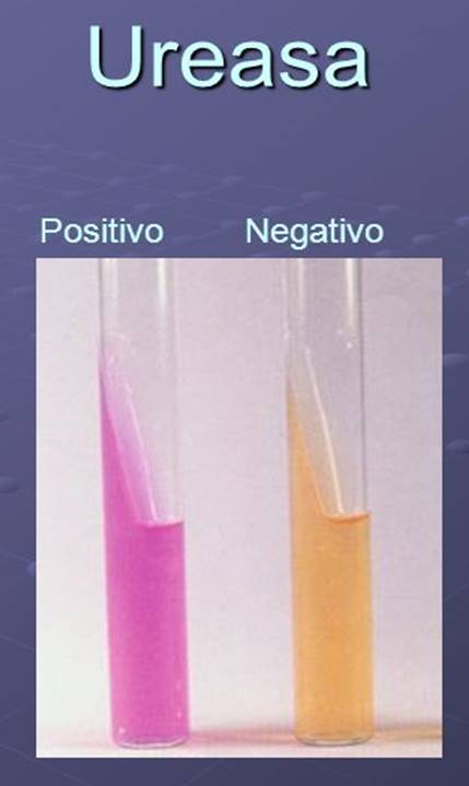 Helicobacter Pylori on emaze