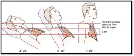בדיקה פיזיקלית של הלב on emaze