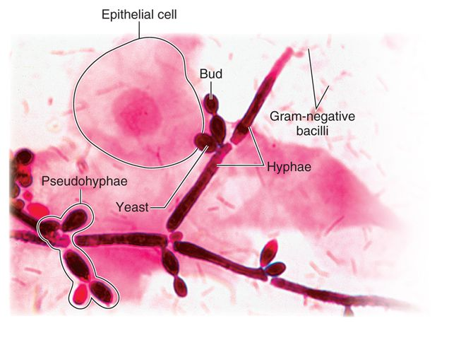 Diseases of Genitourinary System on emaze