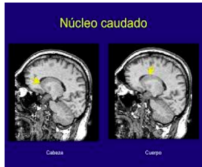 nucleo caudado on emaze