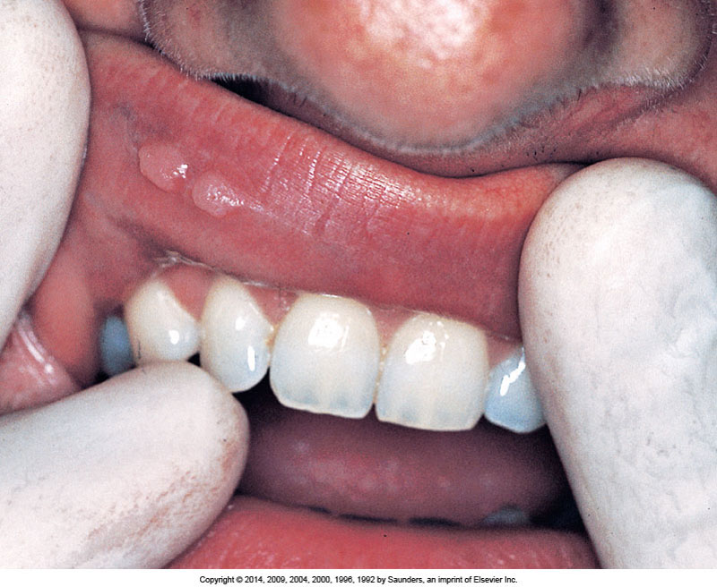 Oral Pathology-RDH at emaze Presentation