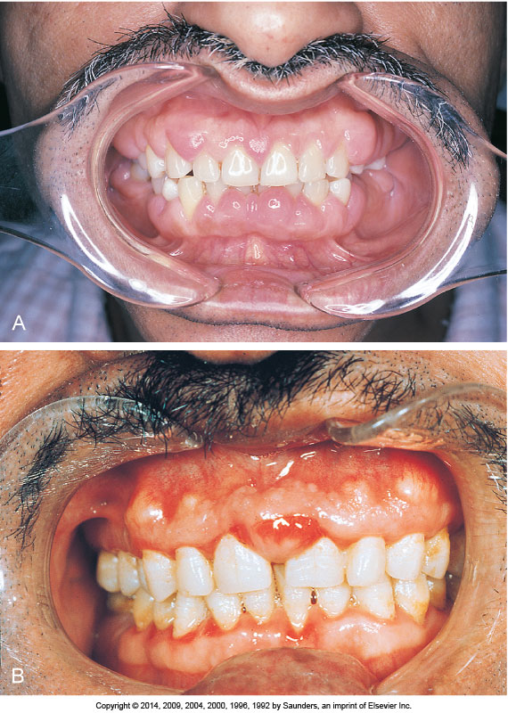 Oral Pathology-RDH at emaze Presentation