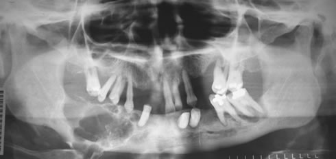 Oral Pathology-RDH on emaze