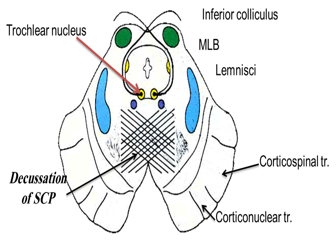 3th seminar brain stem.pptx on emaze