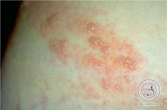 Diagnóstico y Semiología dermatológica ONLINE.pptx on emaze