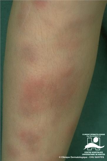 Diagnóstico y Semiología dermatológica ONLINE.pptx on emaze