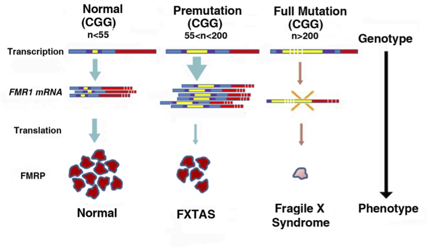 Fragile X Syndrome on emaze