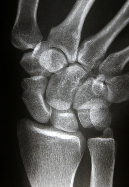 CLASE # 2.pptx at emaze Presentation