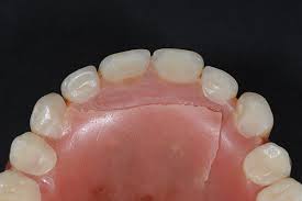 non-metallic on emaze