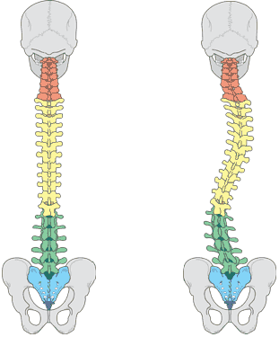 Spinal Muscular Atrophy on emaze