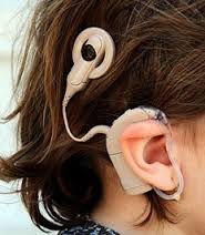 Bionic Ear at emaze Presentation