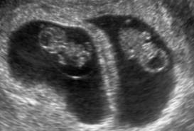 Spreekbeurt Tweelingen on emaze