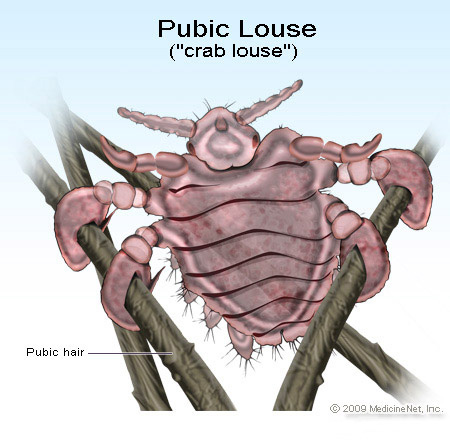 Symptoms of Pubic Lice at emaze Presentation