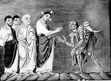 Leprosy at emaze Presentation