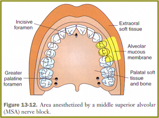 Maxillary Anesthesia -2.pptx on emaze