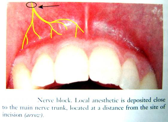 newmicrosoftofficepowerpointpresentation2-140228140444-phpapp02.pptx on ...