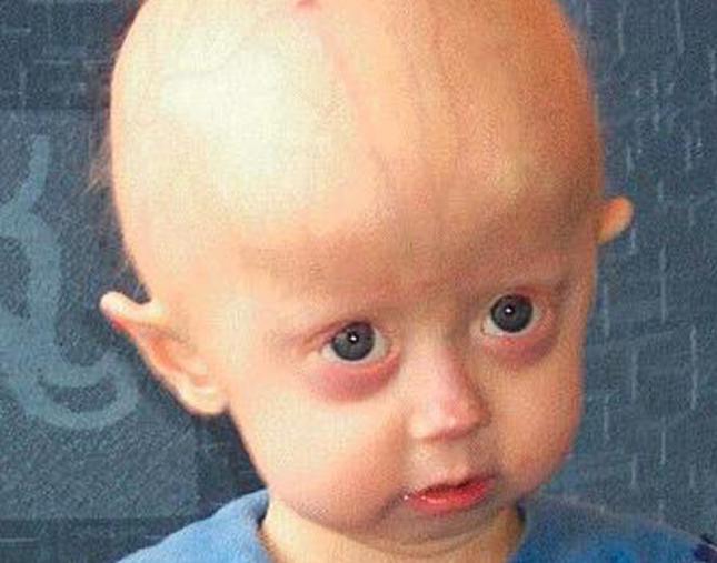 MutacionetGjenetike. copy2 on emaze