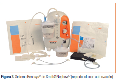 SISTEMA VAC at emaze Presentation