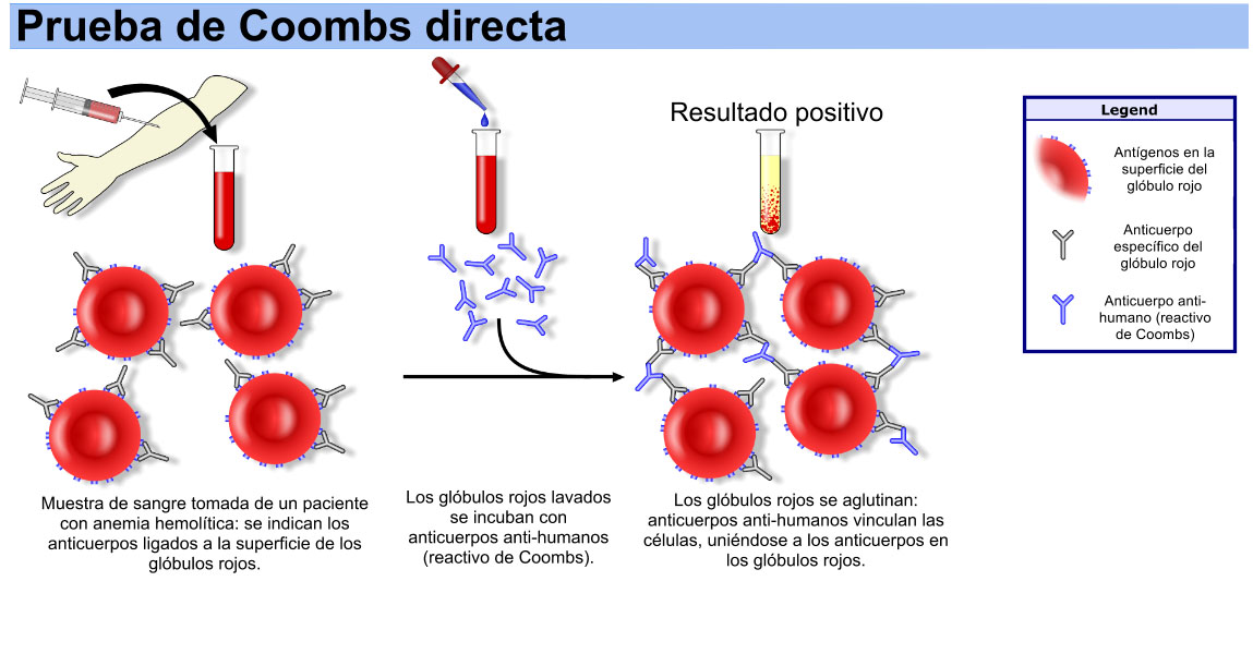 Coombs Direto Para Que Serve - RETOEDU