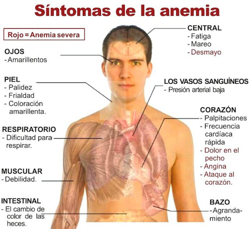 Anemia Hemolítica Autoinmune on emaze