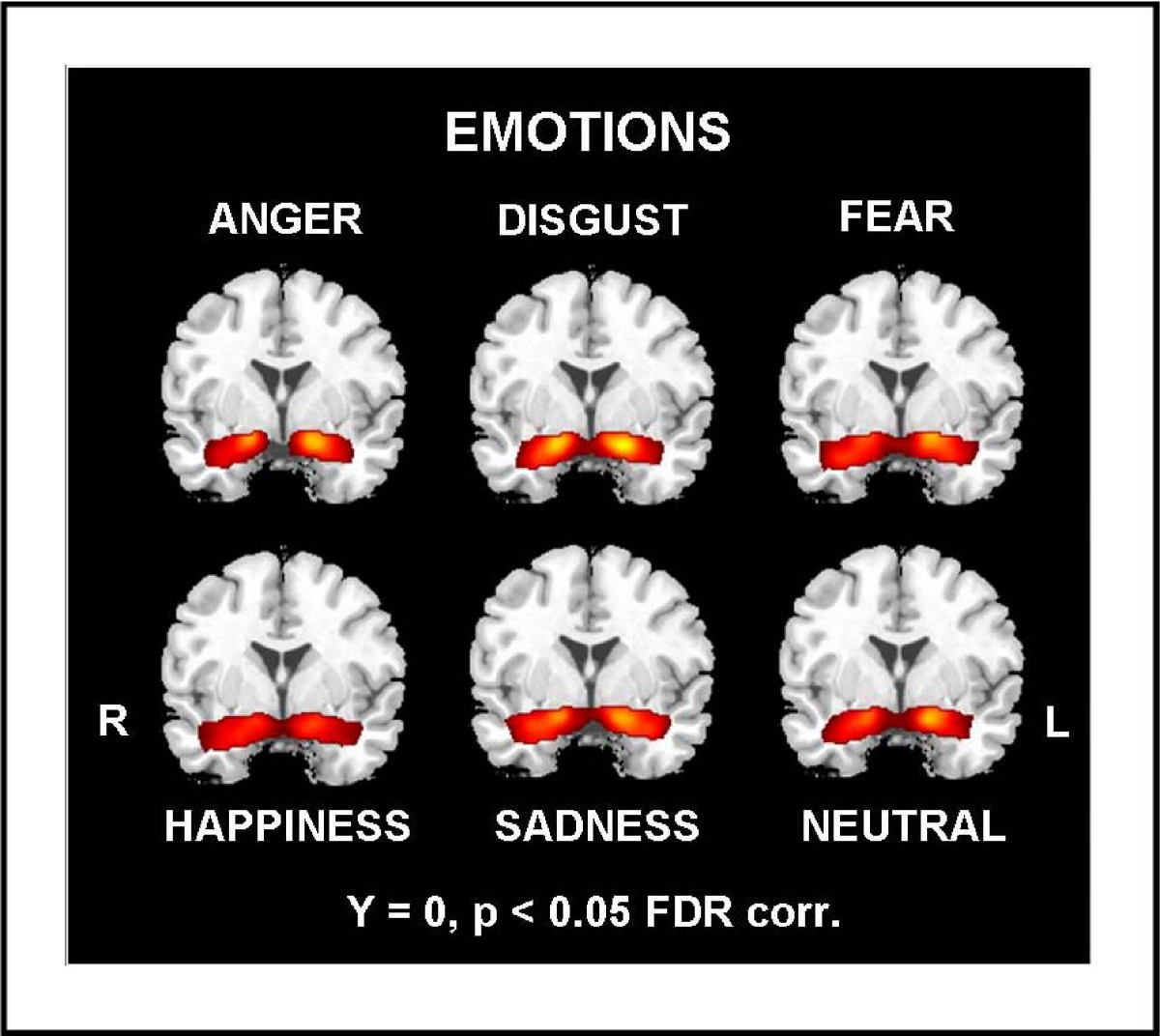 The Amygdala at emaze Presentation