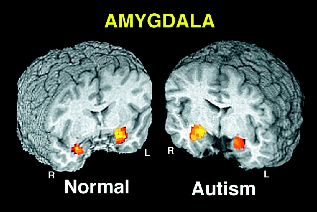 The Amygdala at emaze Presentation