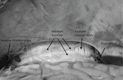 NEUROANATOMÍA DE LA on emaze