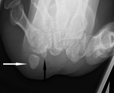 Chapter 4 Part 1 copy1 on emaze