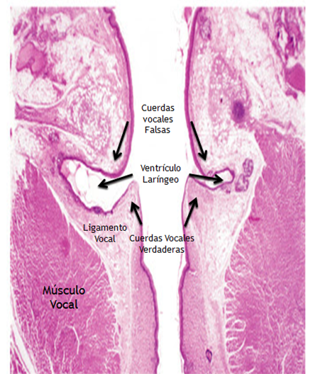 Laringe & tráquea on emaze