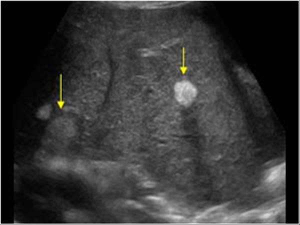 at emaze Presentation