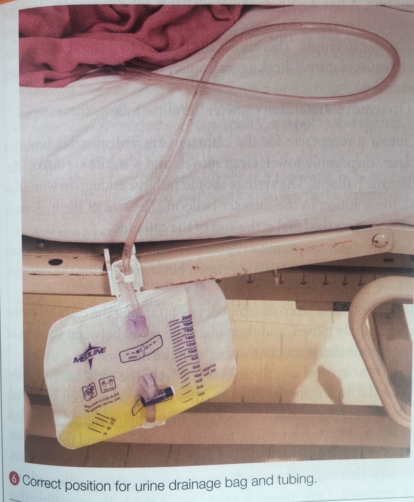 The Foley Catheter at emaze Presentation