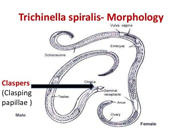Trichinella on emaze