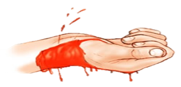 HEMORRAGIAS-KATHALINA DIAZ at emaze Presentation