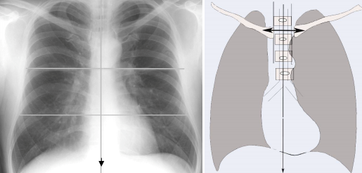 Radiographie Thoracique on emaze
