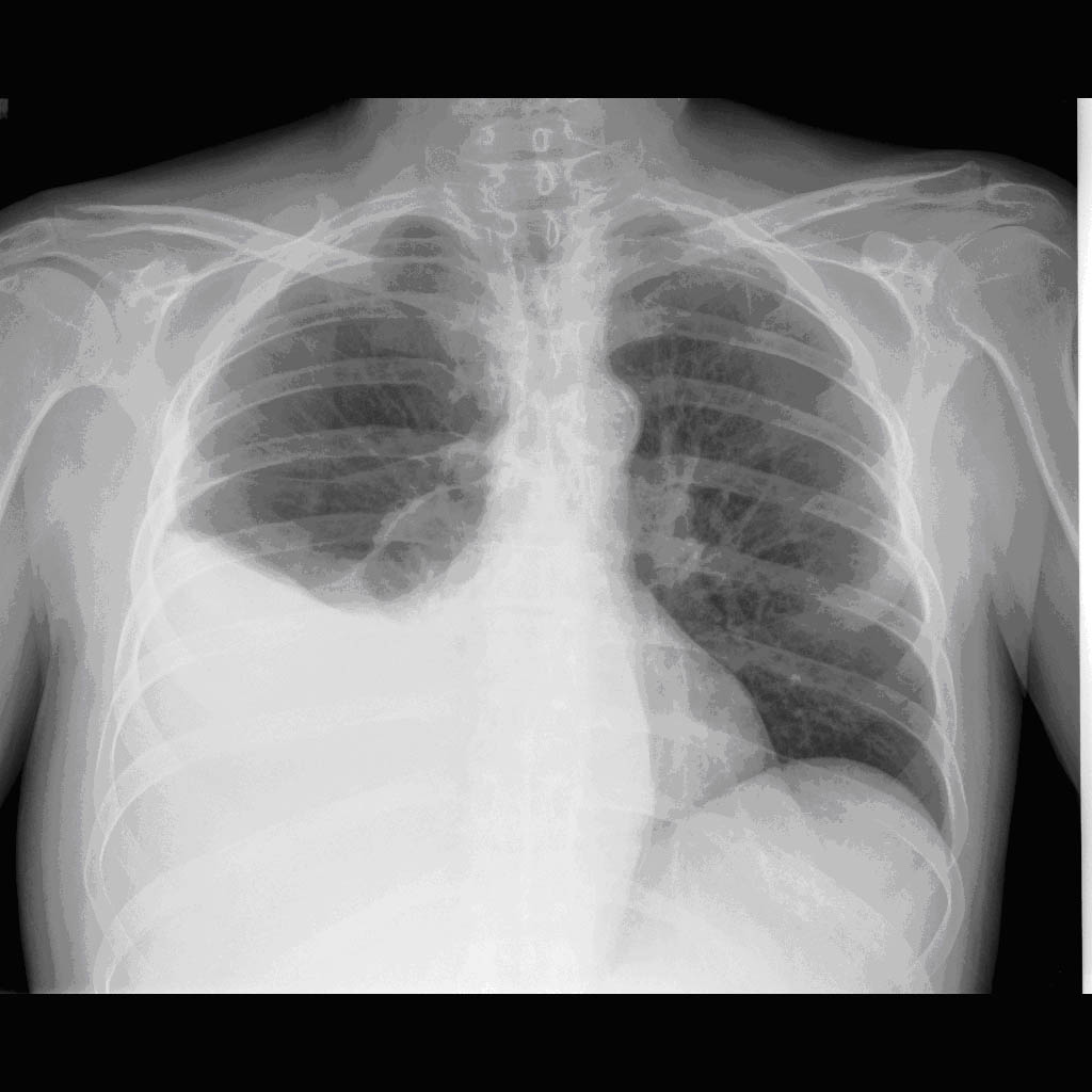 Radiographie Thoracique on emaze