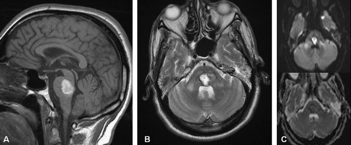 Protuberancia on emaze