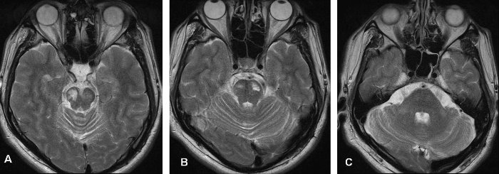Protuberancia on emaze