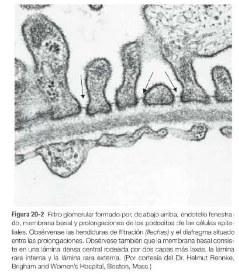 Glomerulopatias on emaze