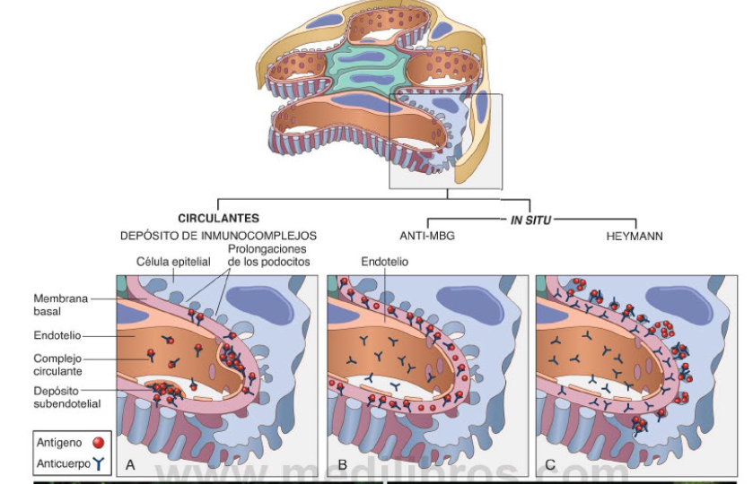 Glomerulopatias on emaze