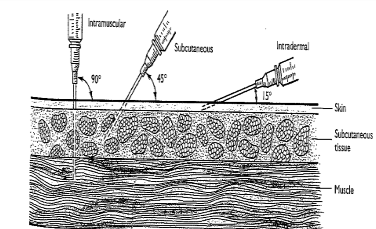 Lecture Parenteral Administration of Medication Injection Route.pptx on ...