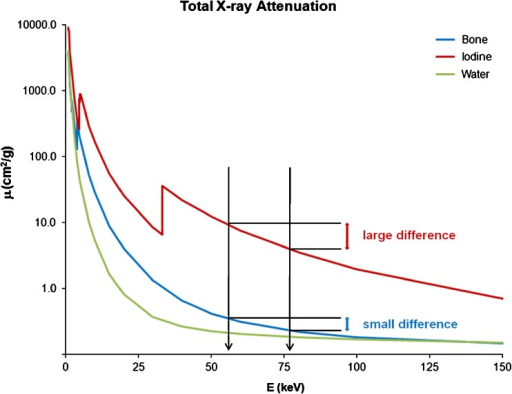 Dual Energy CT on emaze