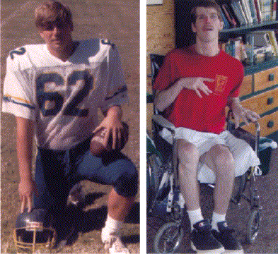 Chorea Huntington on emaze