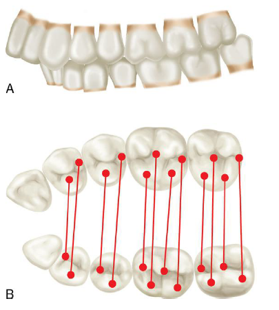 ALINEACIÓN on emaze