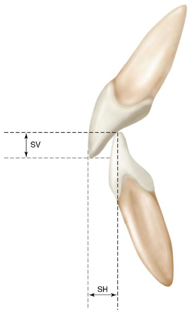 ALINEACIÓN on emaze