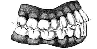 ALINEACIÓN on emaze