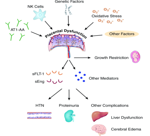 PREECLAMPSIA ECLAMPSIA at emaze Presentation