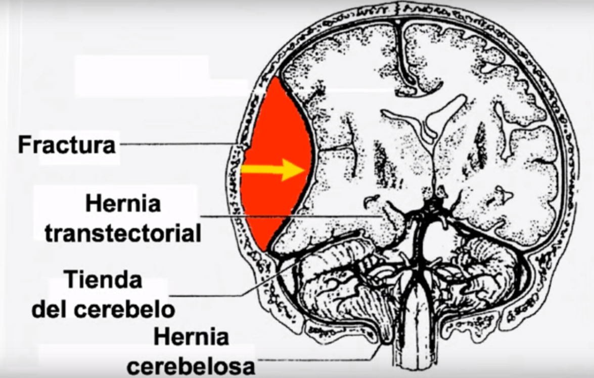 III, IV, VI Par on emaze
