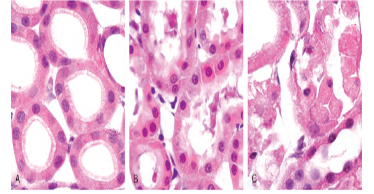 LESIÓN , MUERTE on emaze