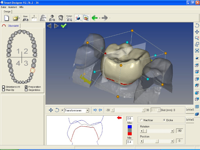 CAD CAM DENTAL on emaze